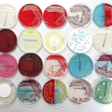 Microbiological culture